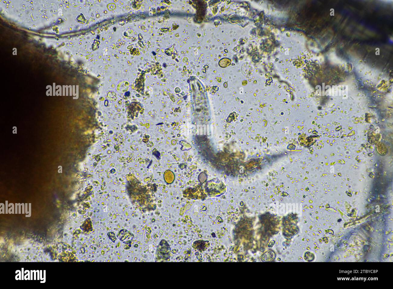 Microorganisms and biology in Compost and soil sample under the ...