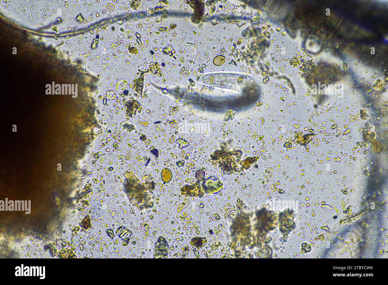 soil microbes under the microscope. microorganisms with fungus in ...