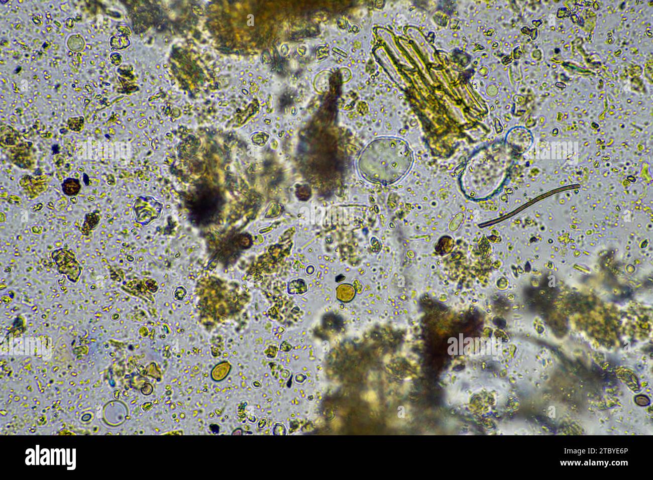 microscopic microorganisms under the microscope Stock Photo - Alamy