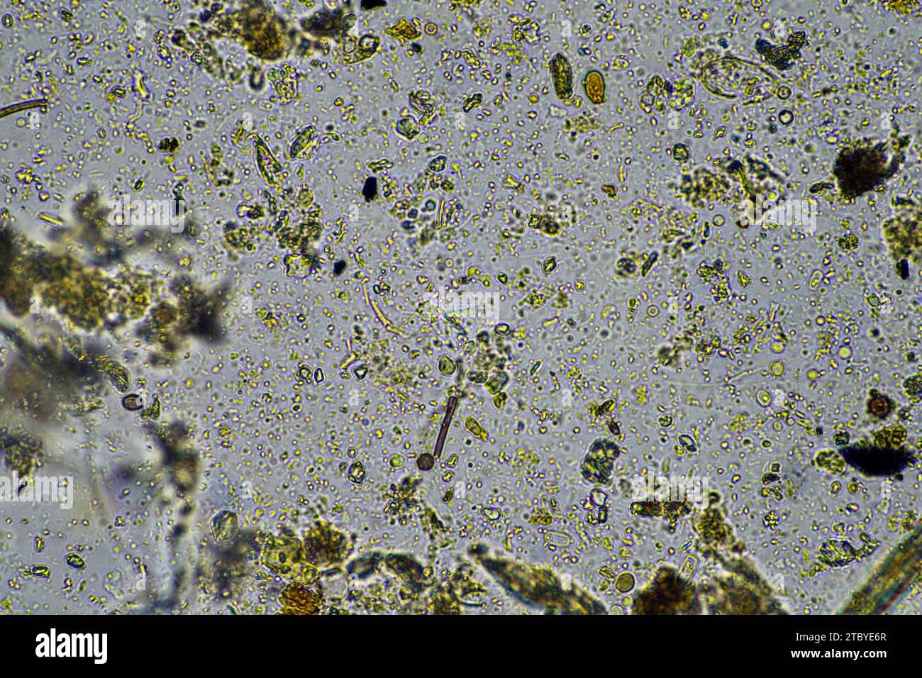 soil microbes under the microscope. microorganisms with fungus in ...