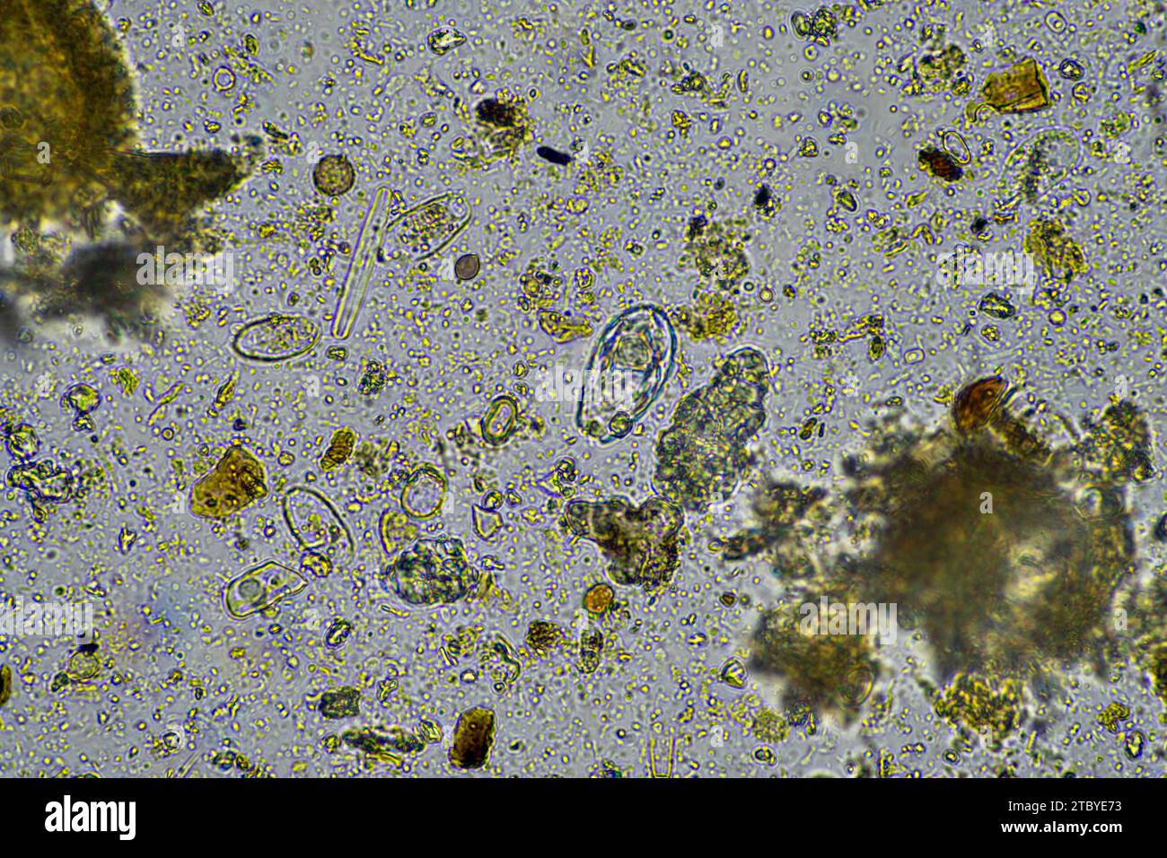 microscopic microorganisms under the microscope Stock Photo - Alamy