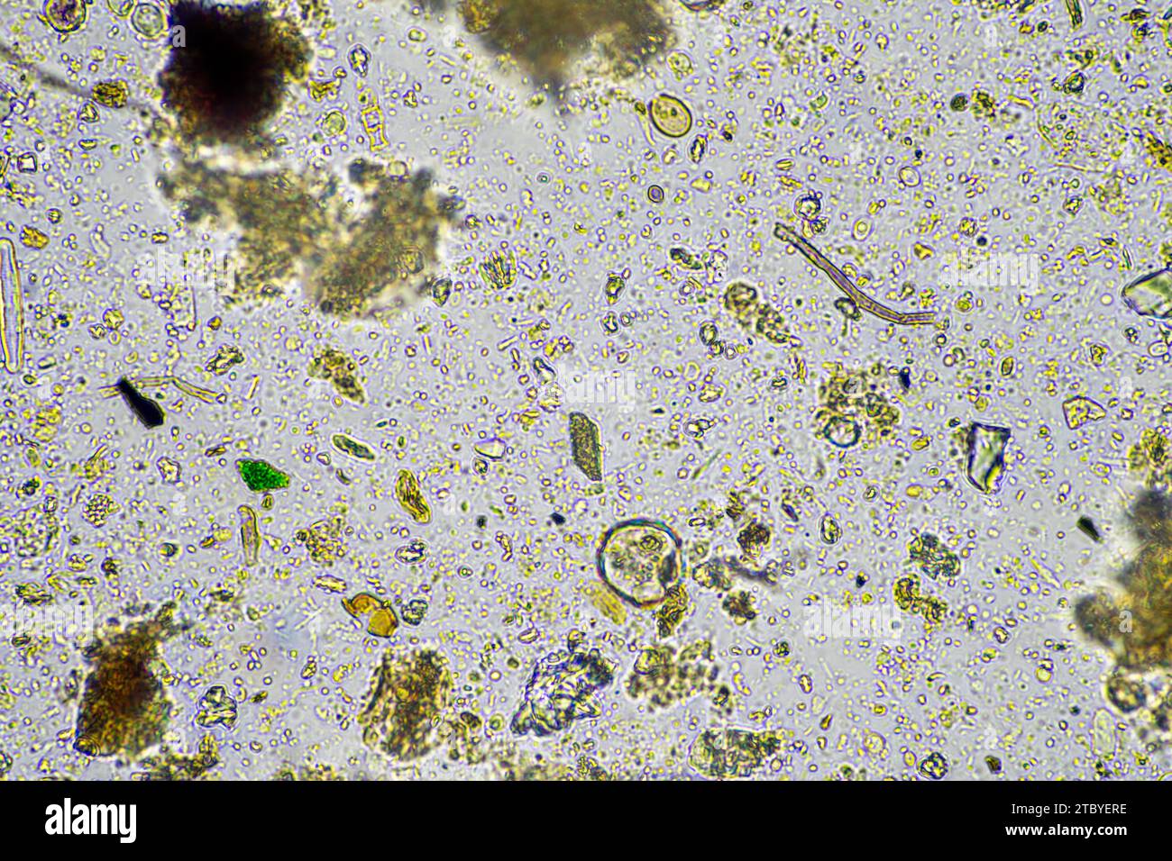 Microorganisms and biology in Compost and soil sample under the ...