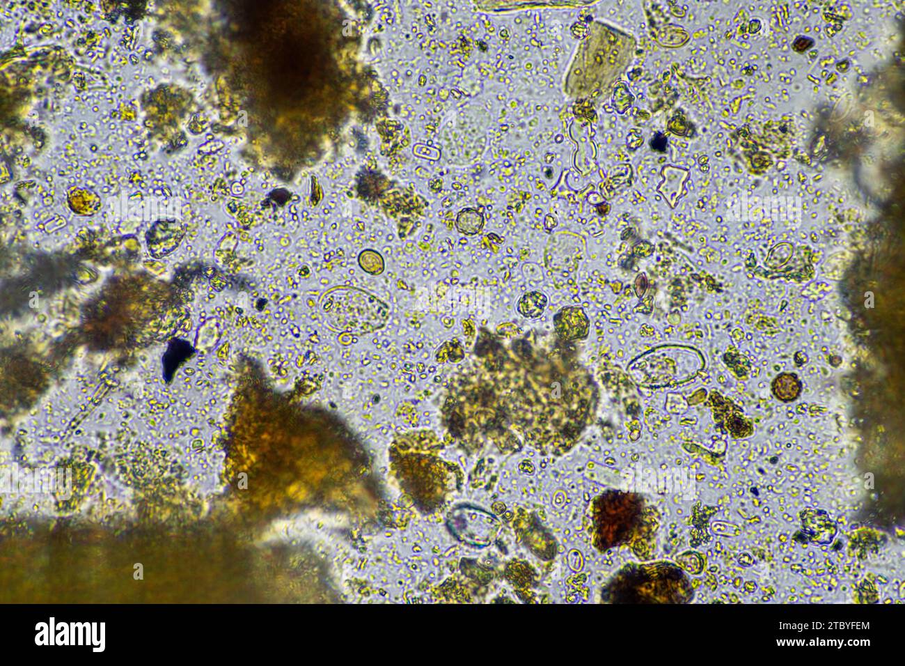 microscopic microorganisms under the microscope Stock Photo - Alamy