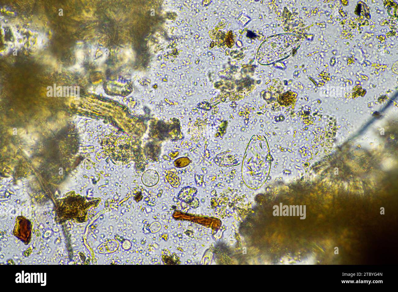 microscopic microorganisms under the microscope Stock Photo - Alamy