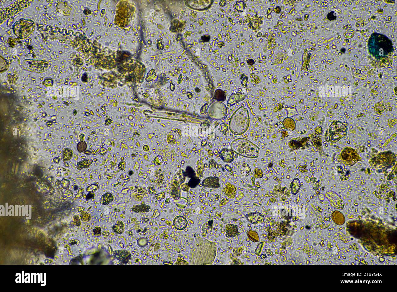microscopic fungus and microorganisms in a sample in australia Stock ...