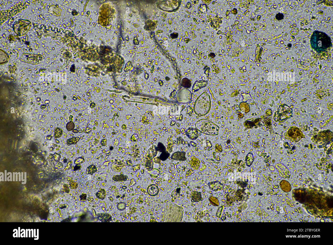 microscopic microorganisms under the microscope Stock Photo - Alamy
