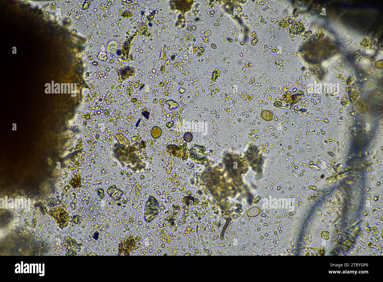 Microorganisms and biology in Compost and soil sample under the ...
