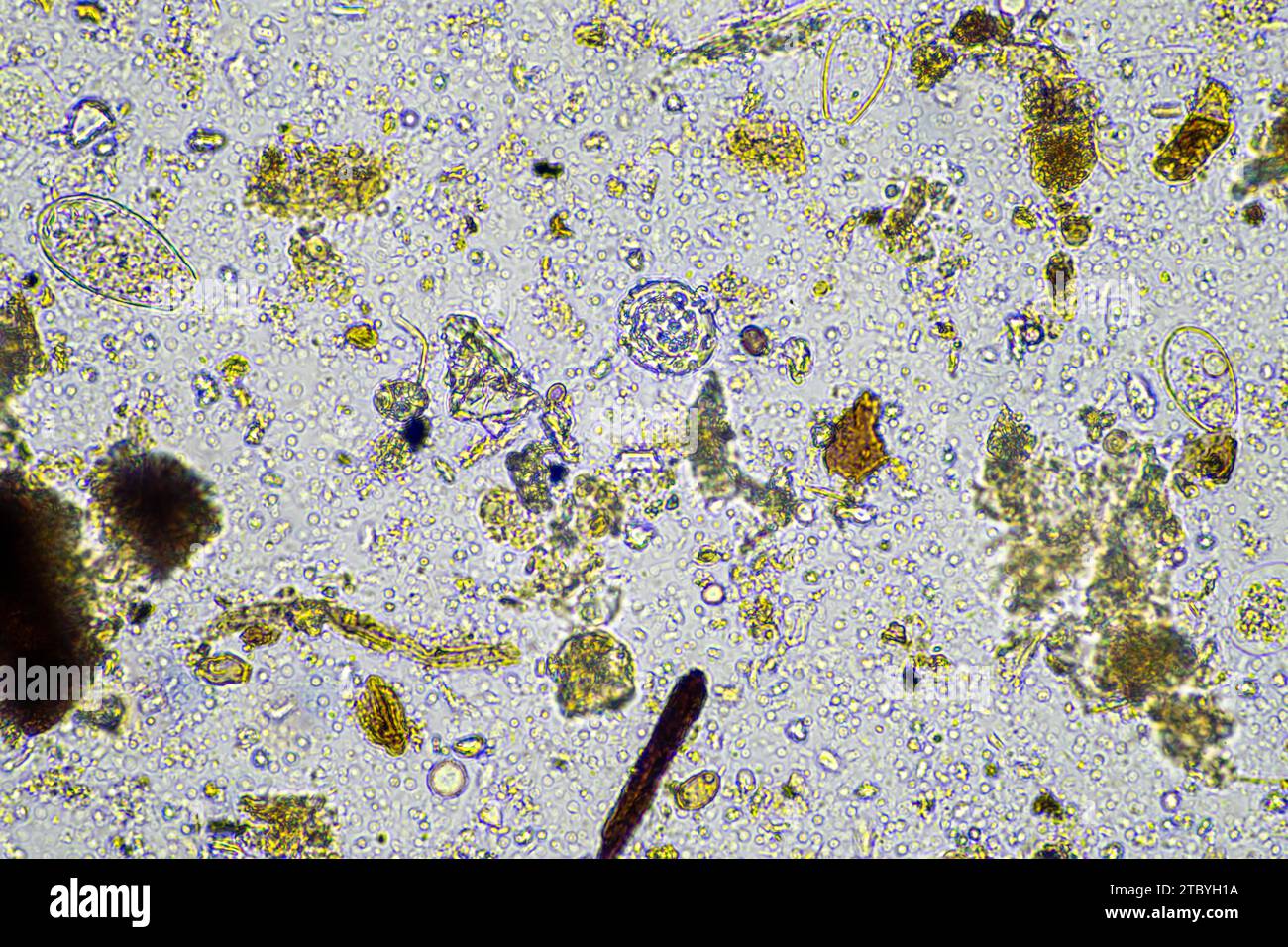 Microorganisms and biology in Compost and soil sample under the ...