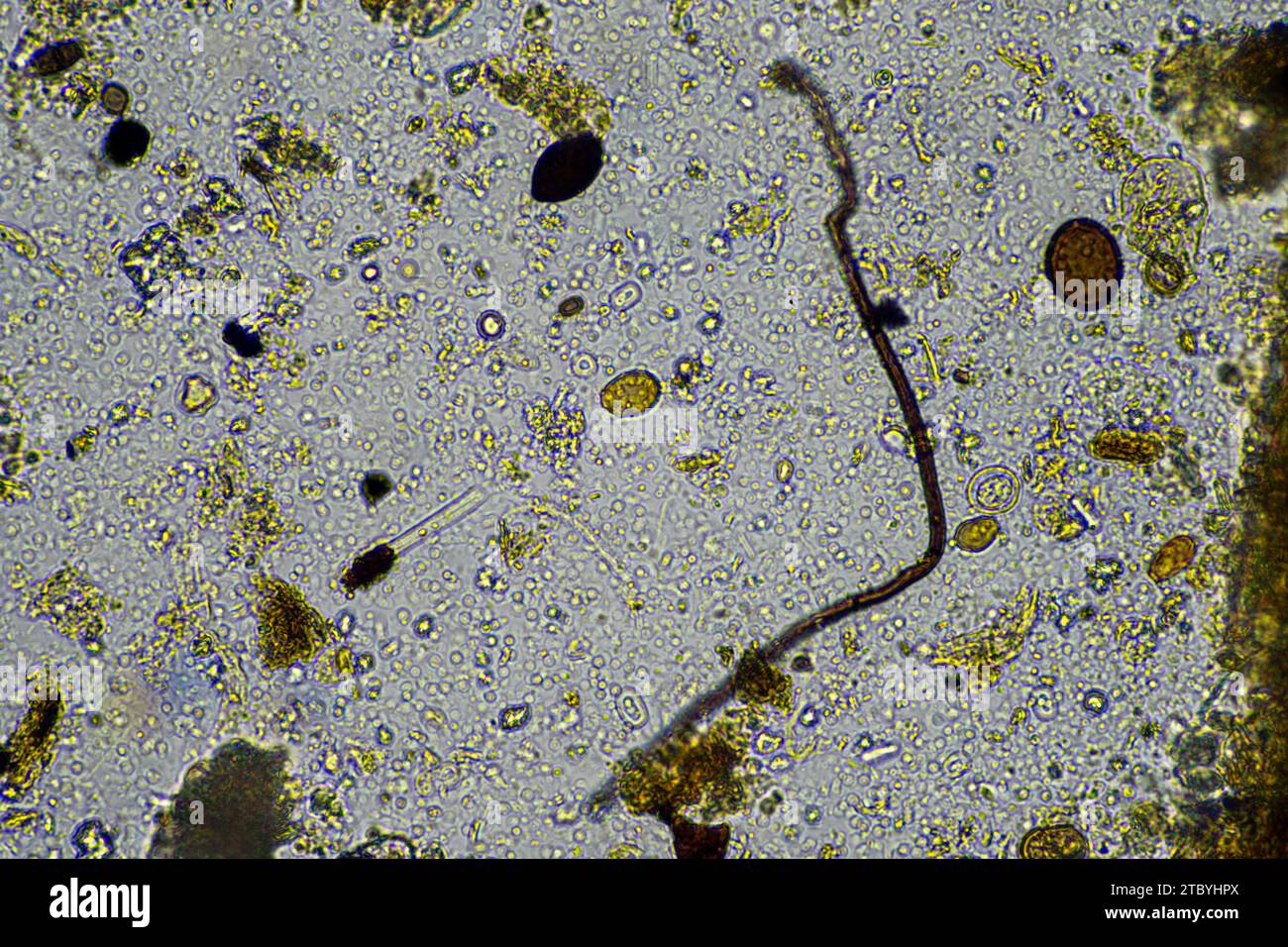 microscopic microorganisms under the microscope Stock Photo - Alamy