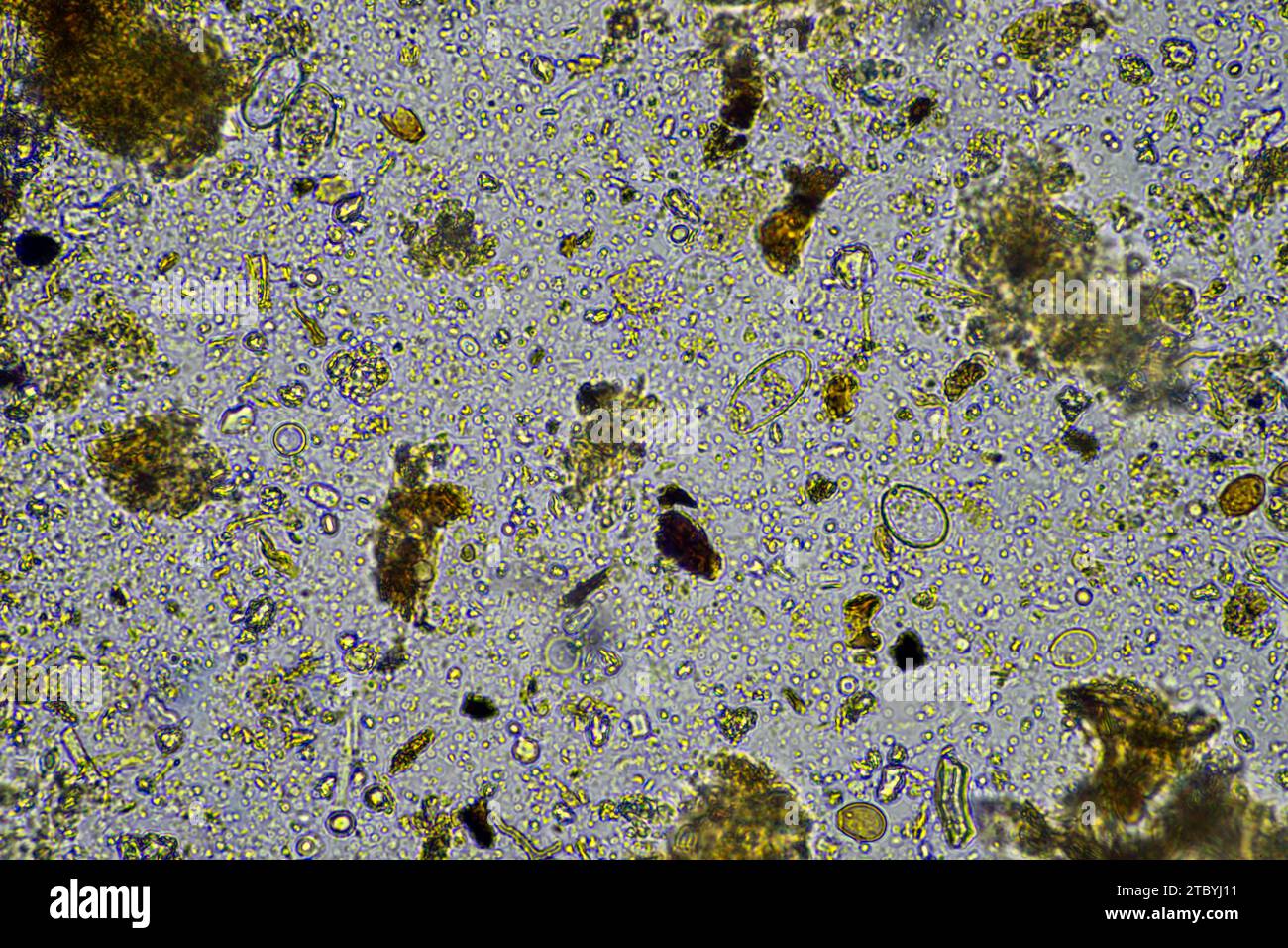 soil microbes under the microscope. microorganisms with fungus in ...