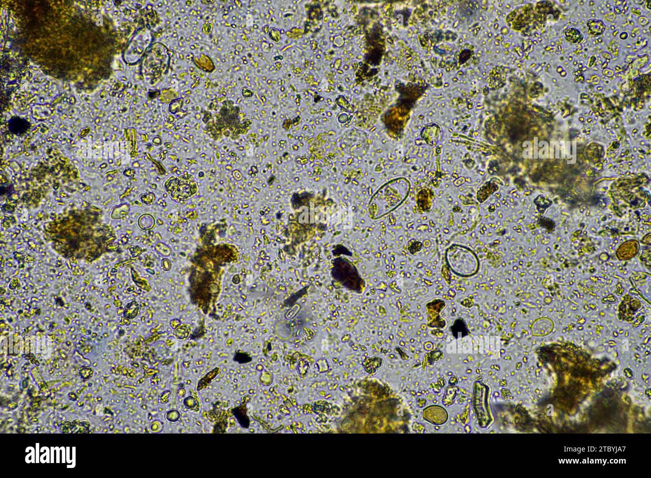Microorganisms and biology in Compost and soil sample under the ...