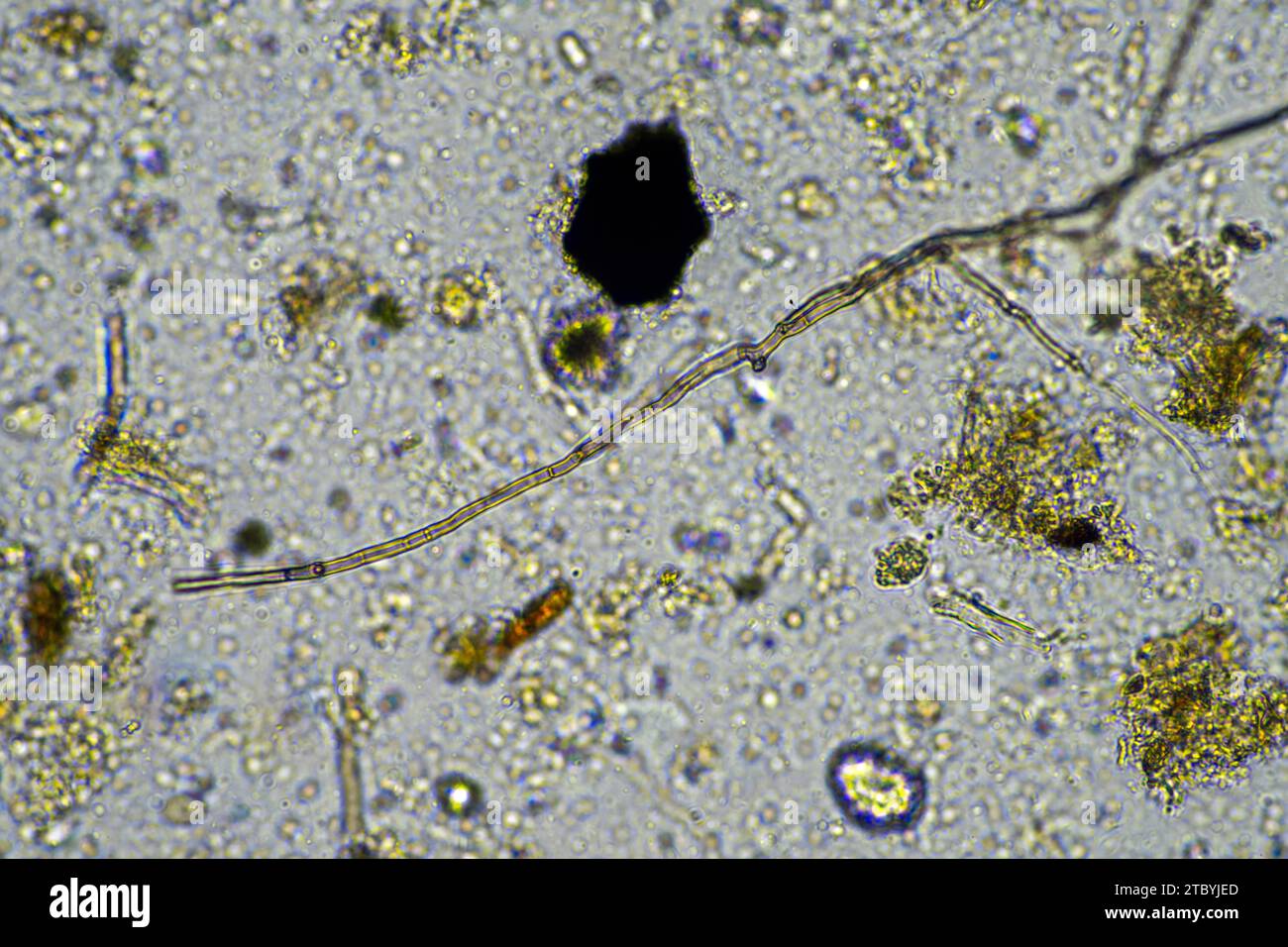 microscopic microorganisms under the microscope Stock Photo - Alamy