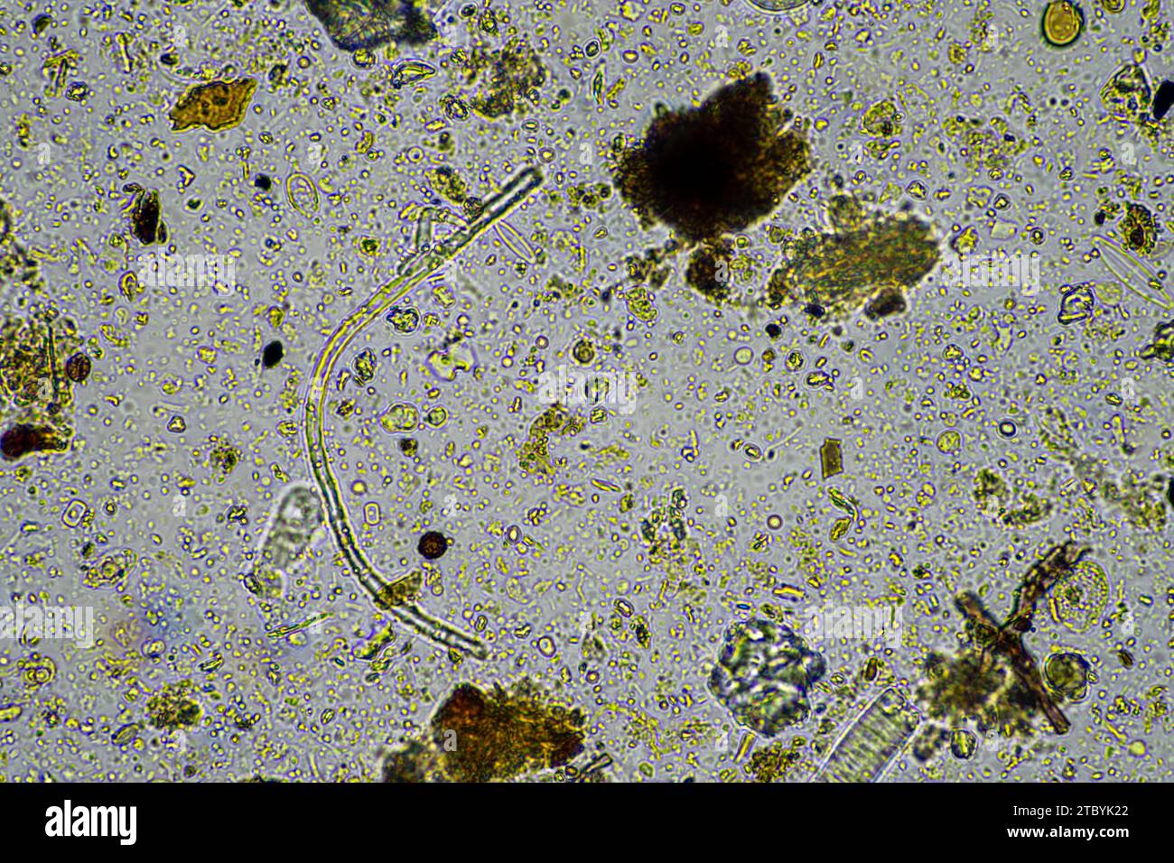 microscopic microorganisms under the microscope Stock Photo - Alamy
