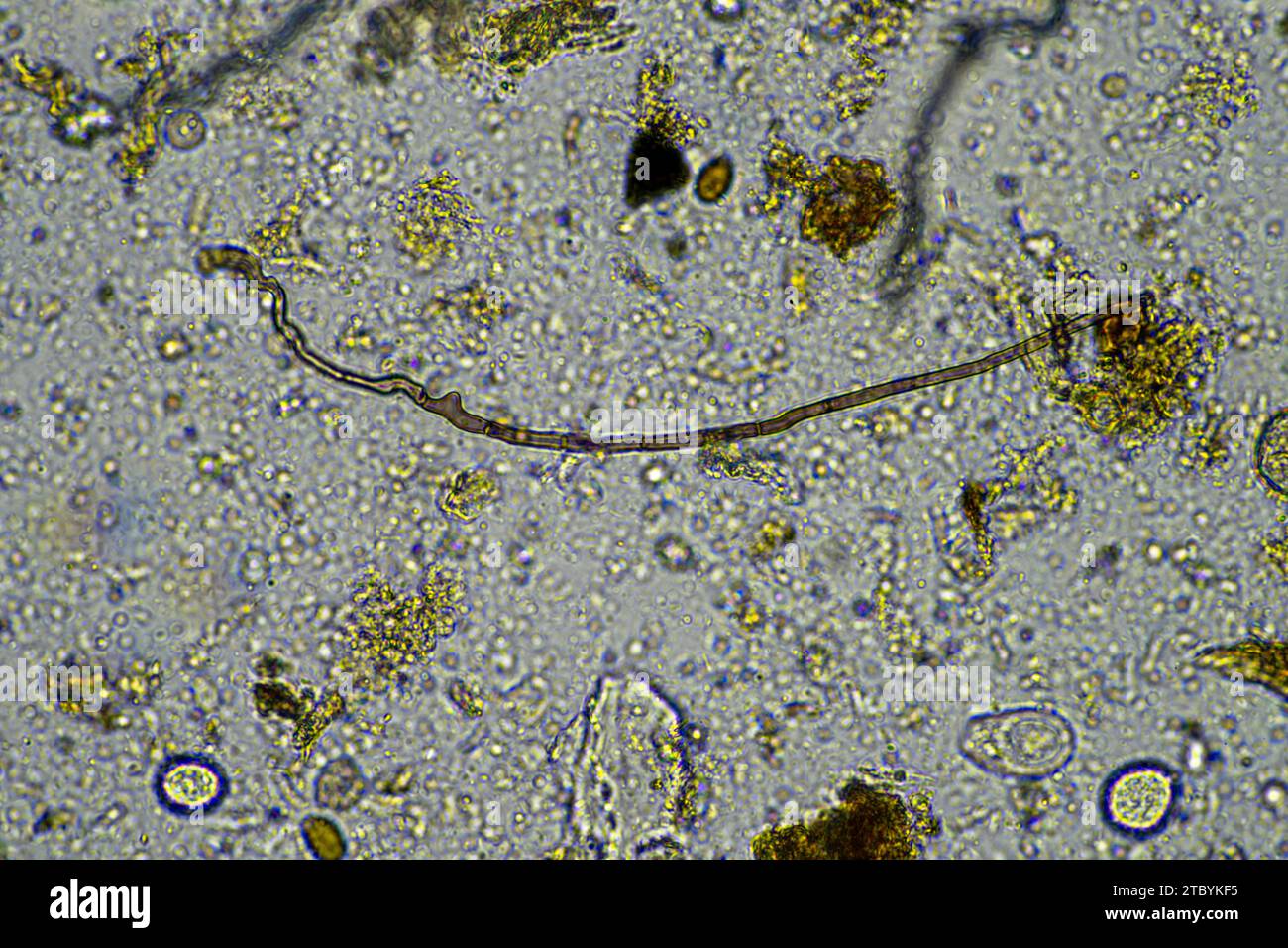 microscopic microorganisms under the microscope Stock Photo - Alamy