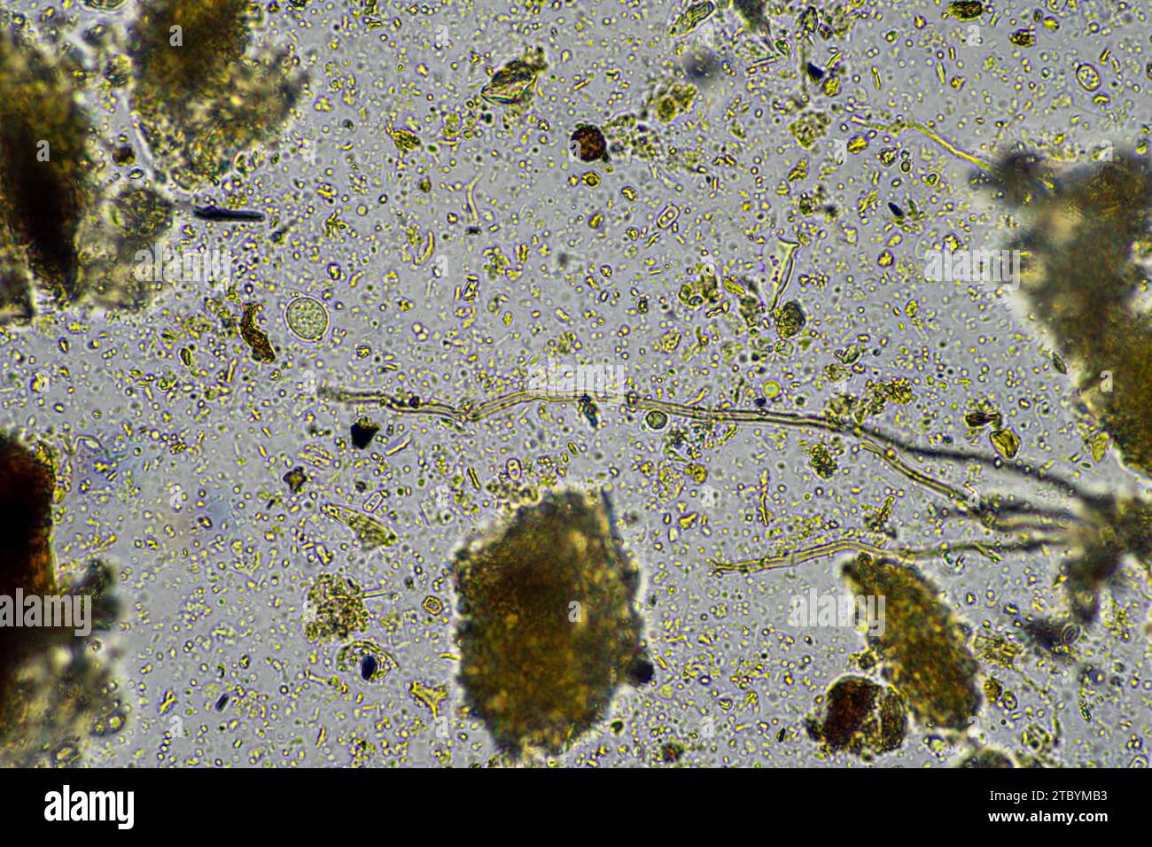 microscopic microorganisms under the microscope Stock Photo - Alamy