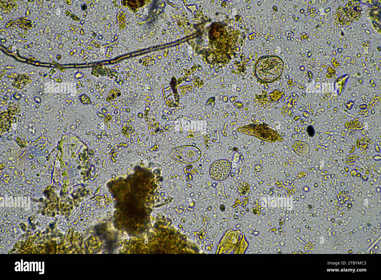 soil microbes under the microscope. microorganisms with fungus in ...