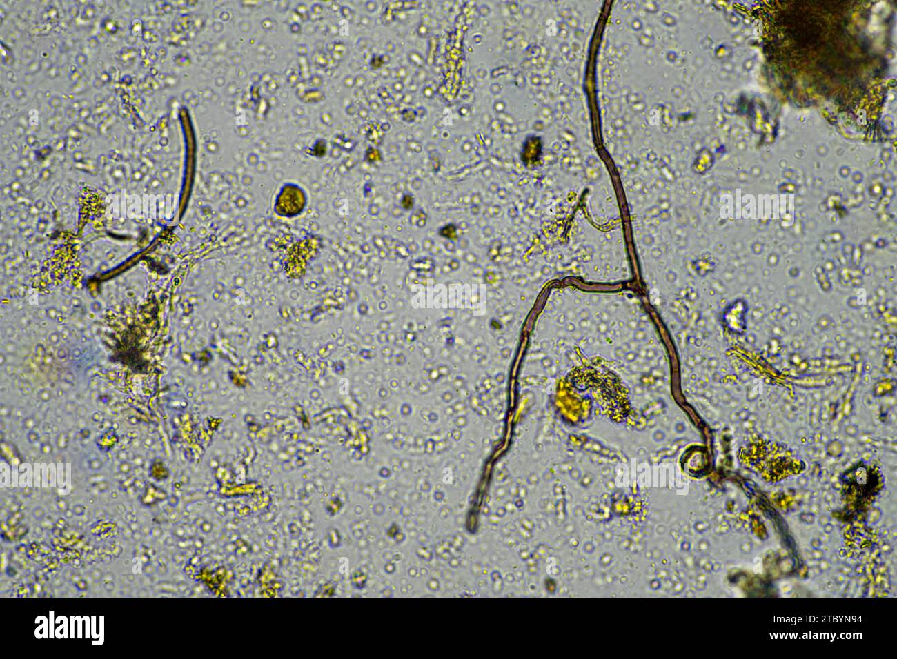microscopic microorganisms under the microscope Stock Photo - Alamy