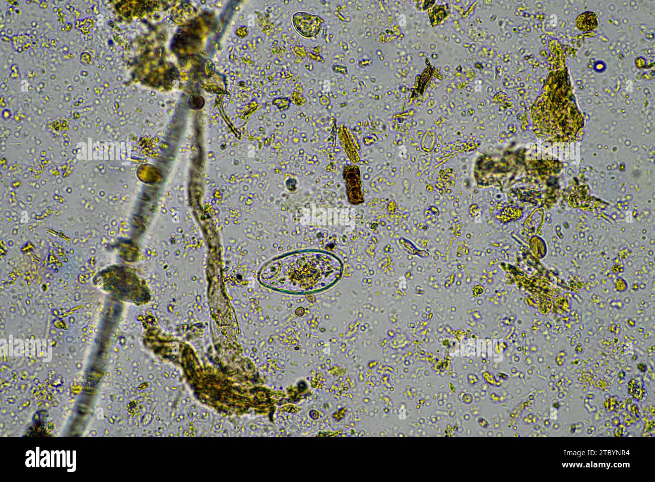 Microorganisms and biology in Compost and soil sample under the ...