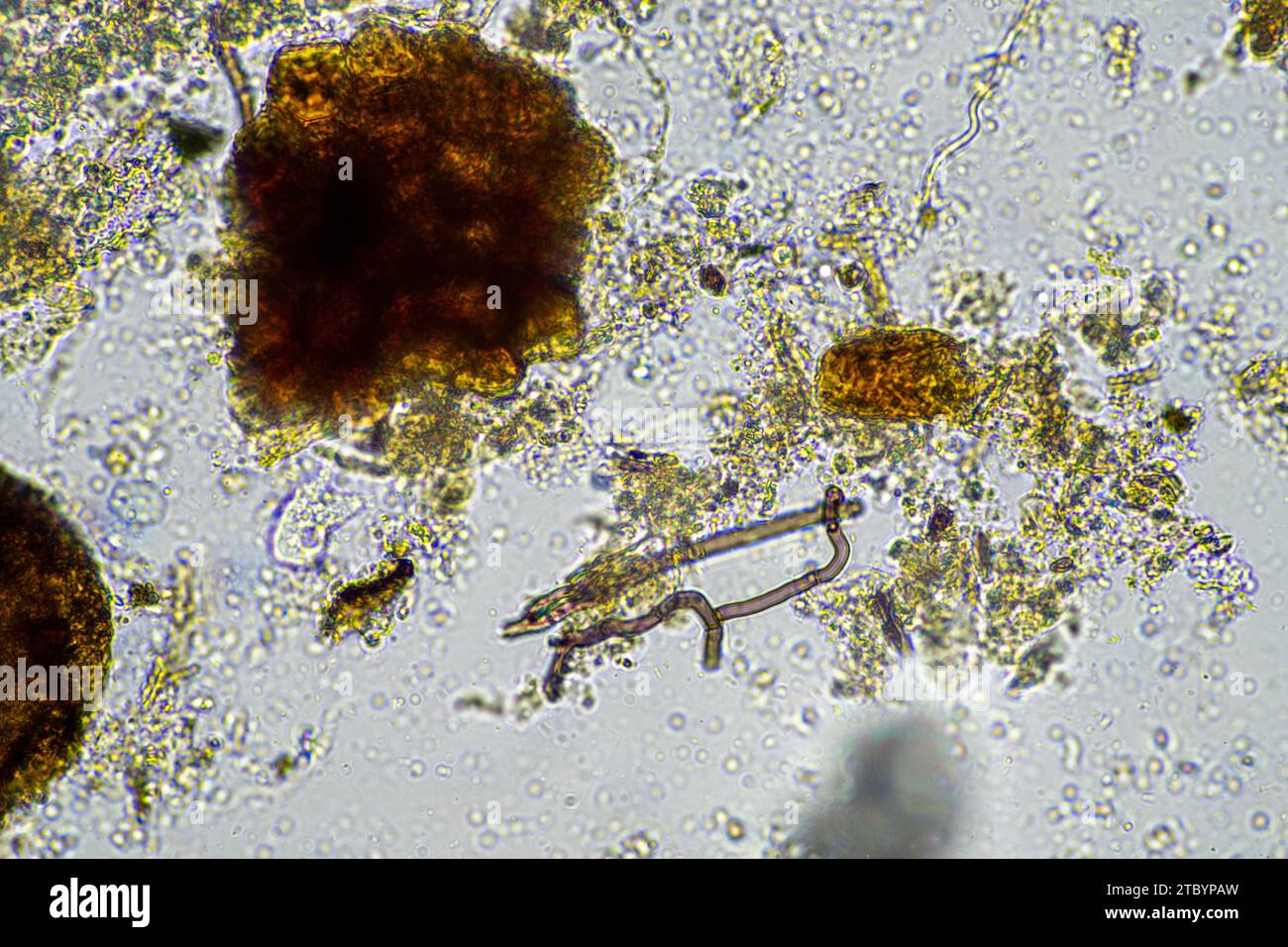 microscopic microorganisms under the microscope Stock Photo - Alamy