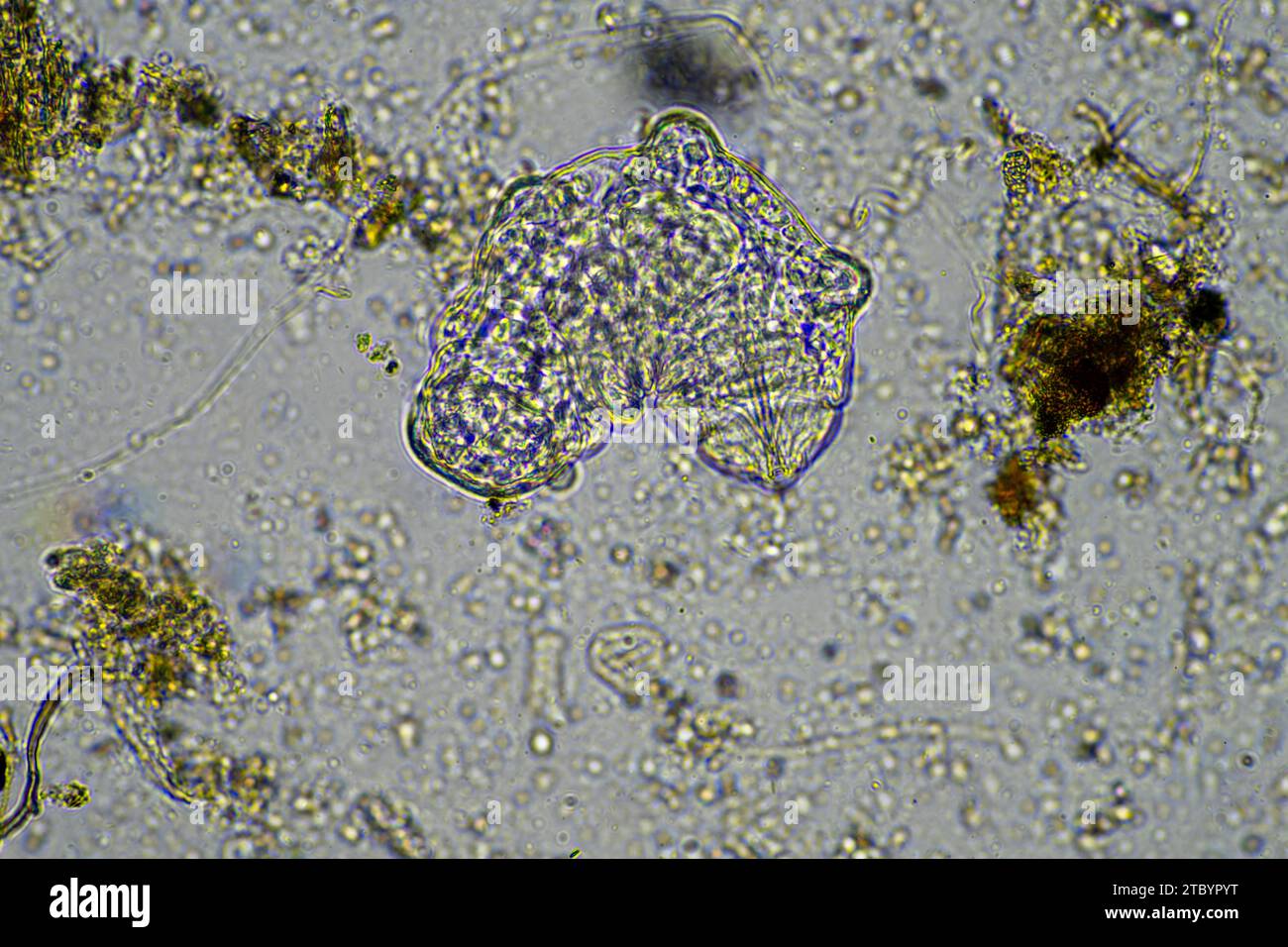 Tardigrade eating hi-res stock photography and images - Alamy