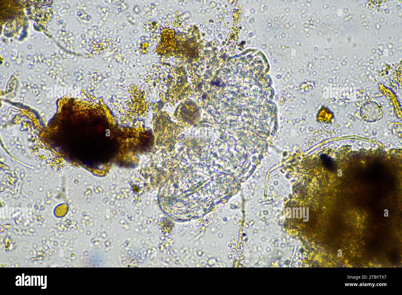 microorganisms and a tardigrade in a soil sample on a farm Stock Photo ...