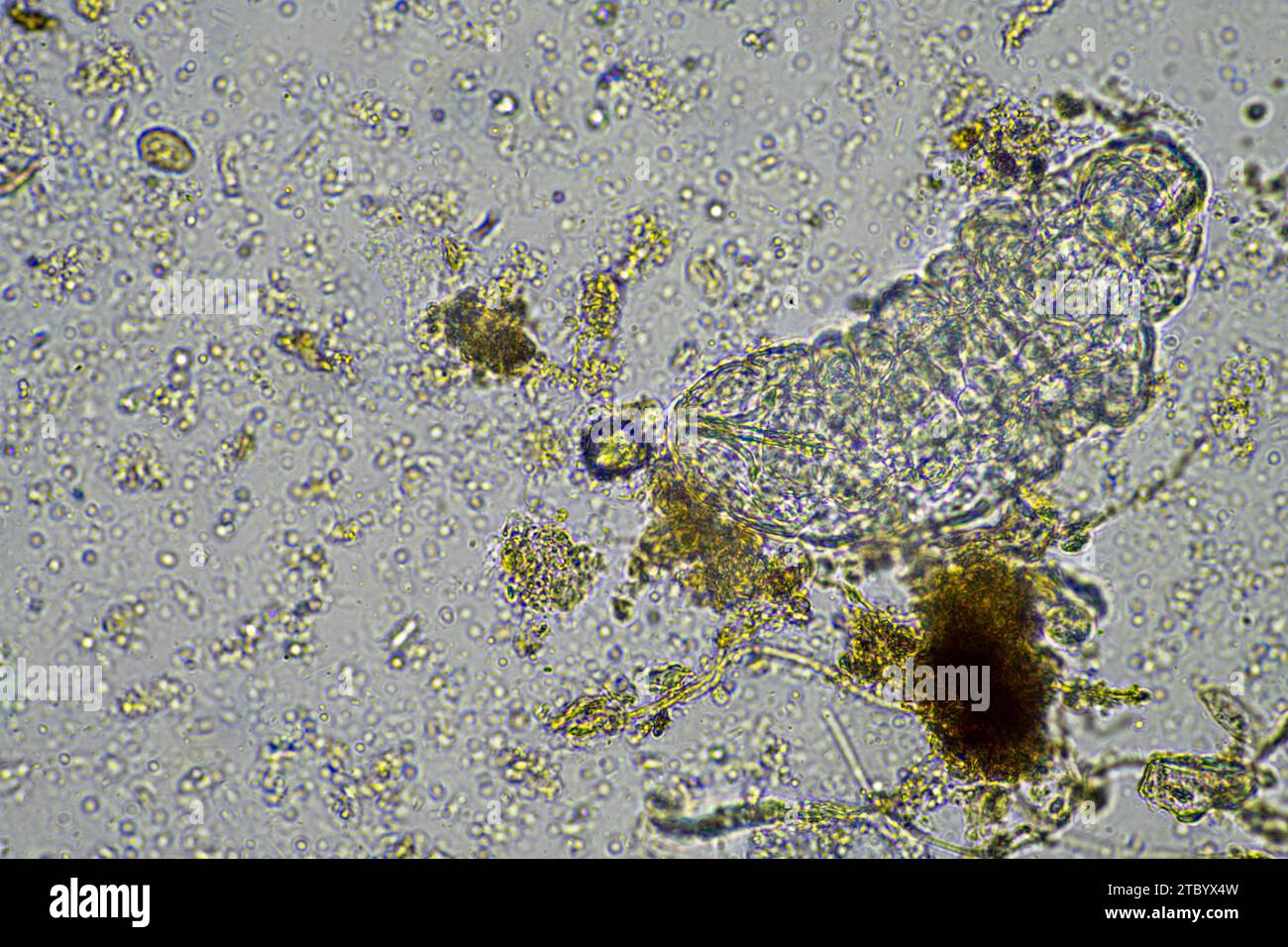 microorganisms and a tardigrade in a soil sample on a farm Stock Photo ...