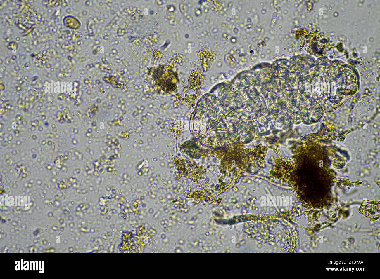 microorganisms and a tardigrade in a soil sample on a farm Stock Photo ...