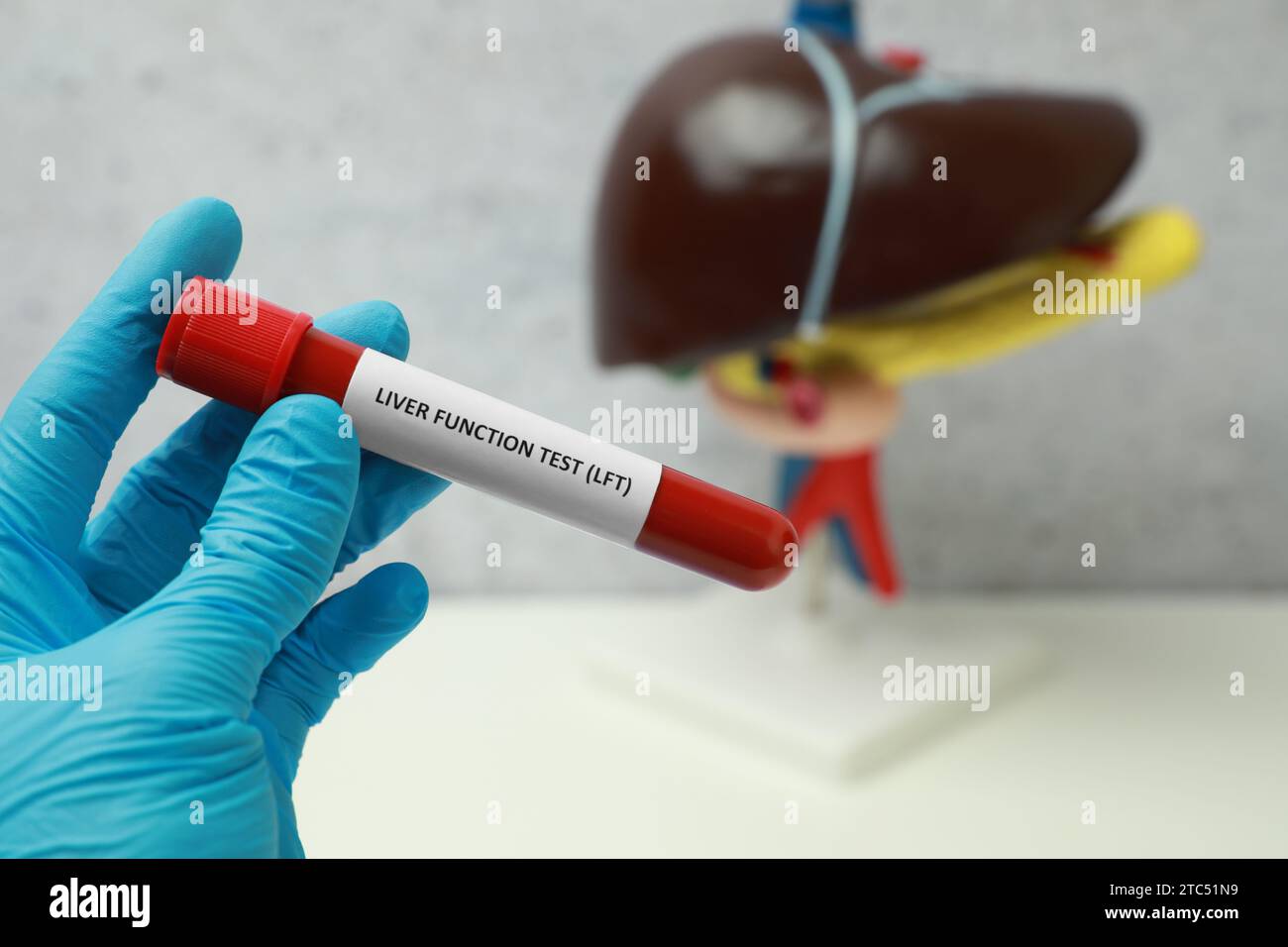 Laboratory worker holding tube with blood sample and label Liver ...