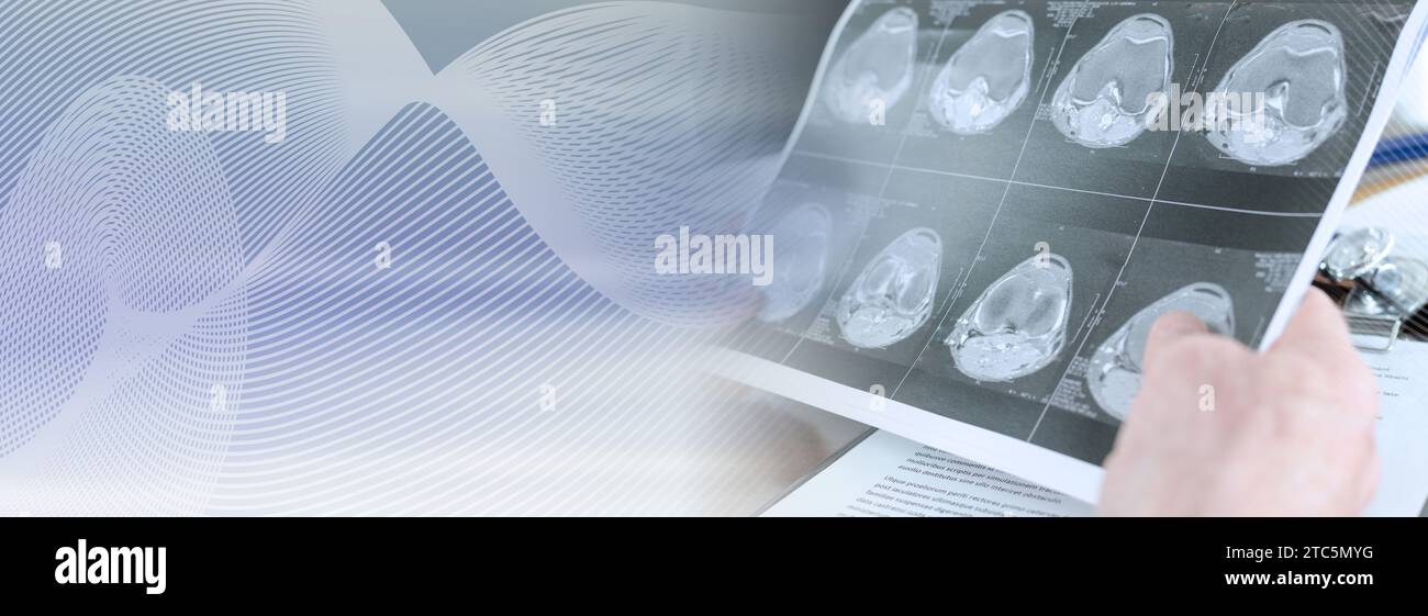 Doctor holding a mri scan, closeup; panoramic banner Stock Photo - Alamy