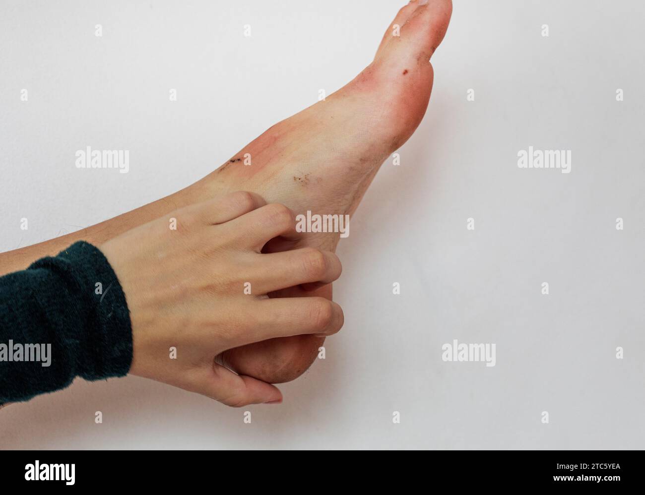 teenage girl scratches her foot with her hand close-up Stock Photo - Alamy