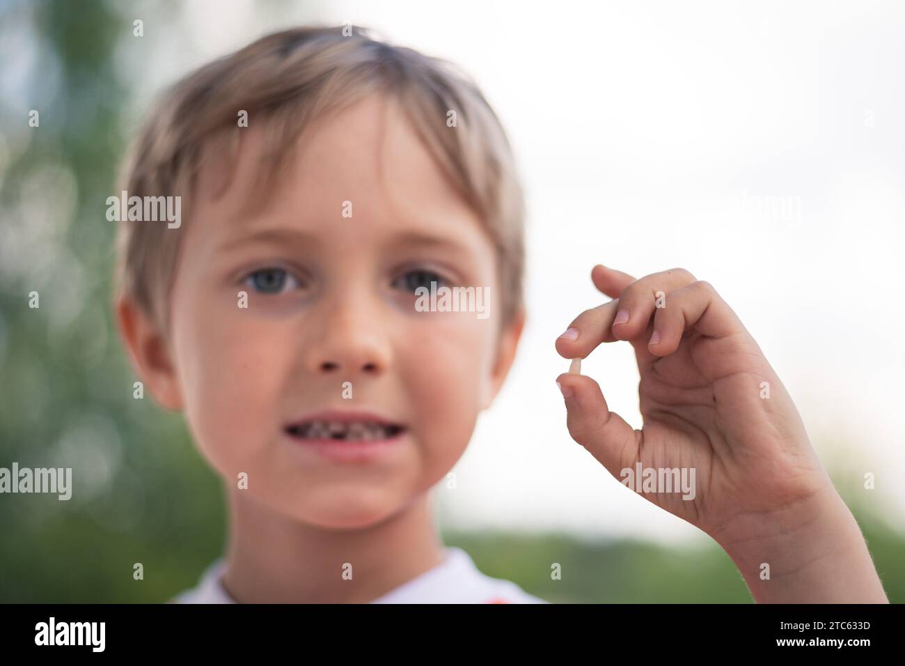 6 years old boy shows the ruptured milk tooth Stock Photo - Alamy