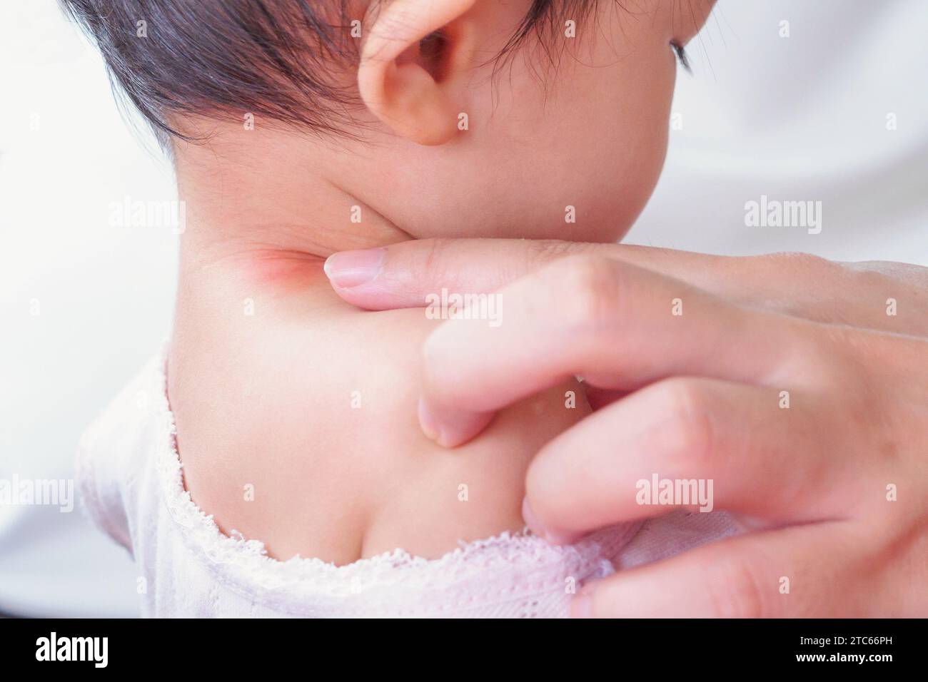 Anti skin rash hi-res stock photography and images - Alamy