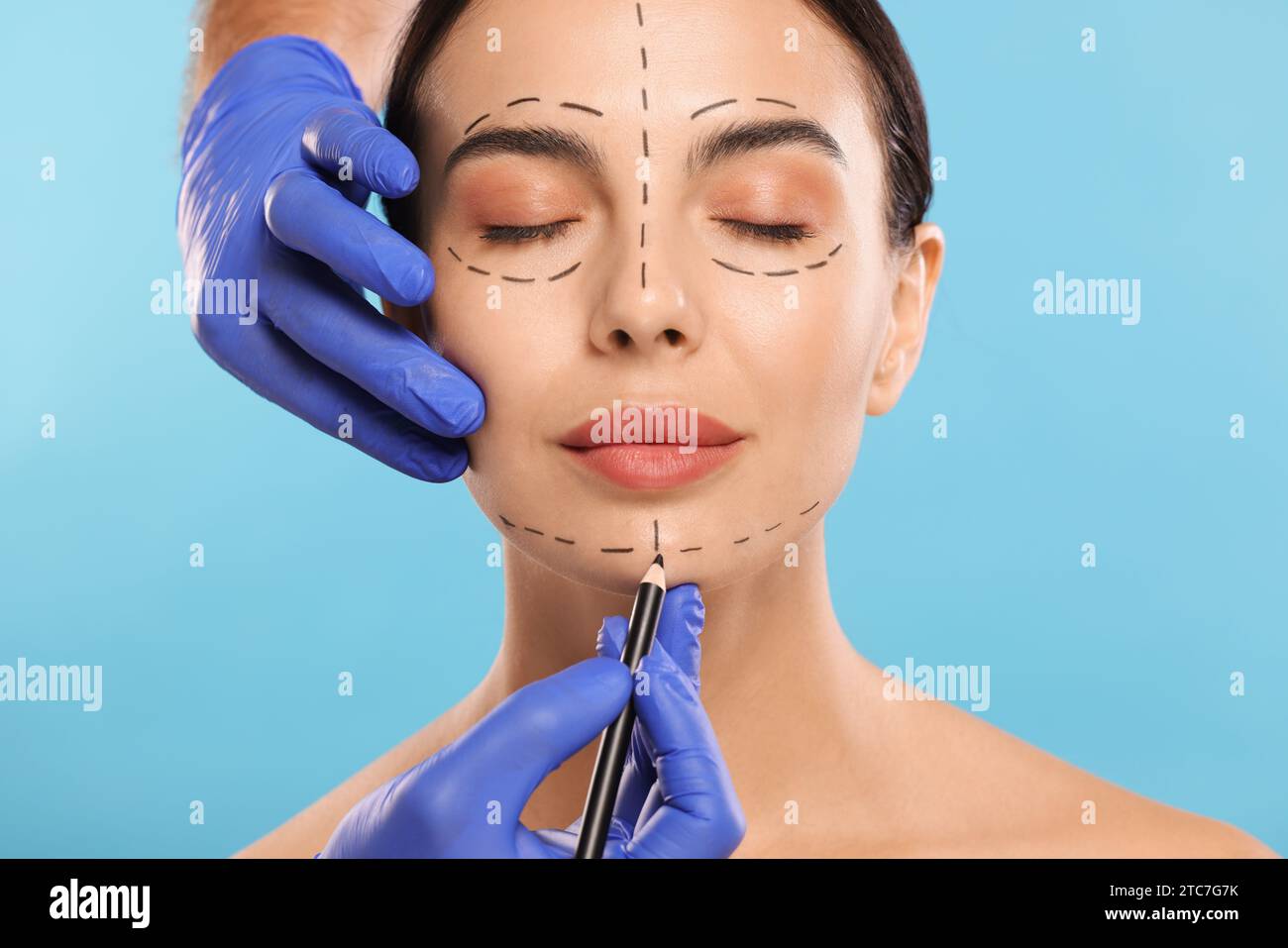 Doctor drawing marks on woman's face for cosmetic surgery operation ...