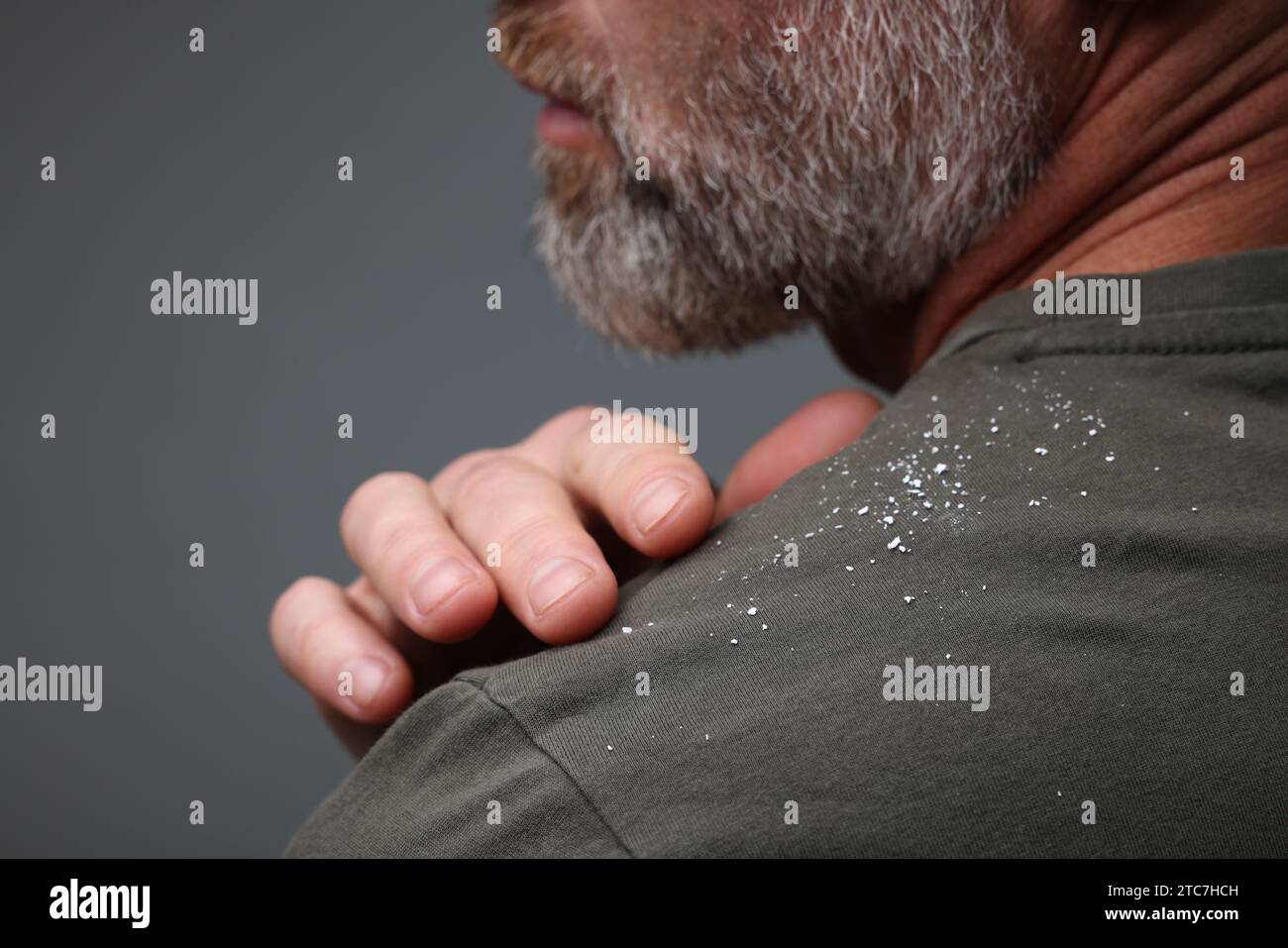 Bearded man brushing dandruff off his t-shirt on grey background ...