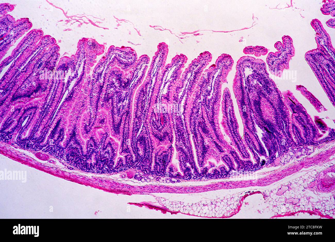 Cross section of intestine with villi. Optical microscopoe ...
