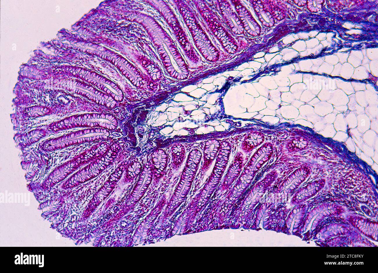 Cross section of intestine with villi. Optical microscopoe ...