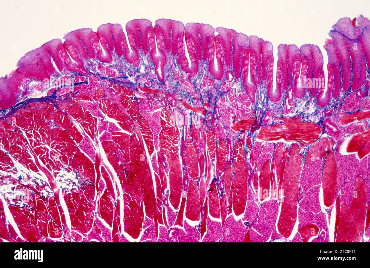 Human tongue cross section with taste buds or gustatory cells. Optical ...