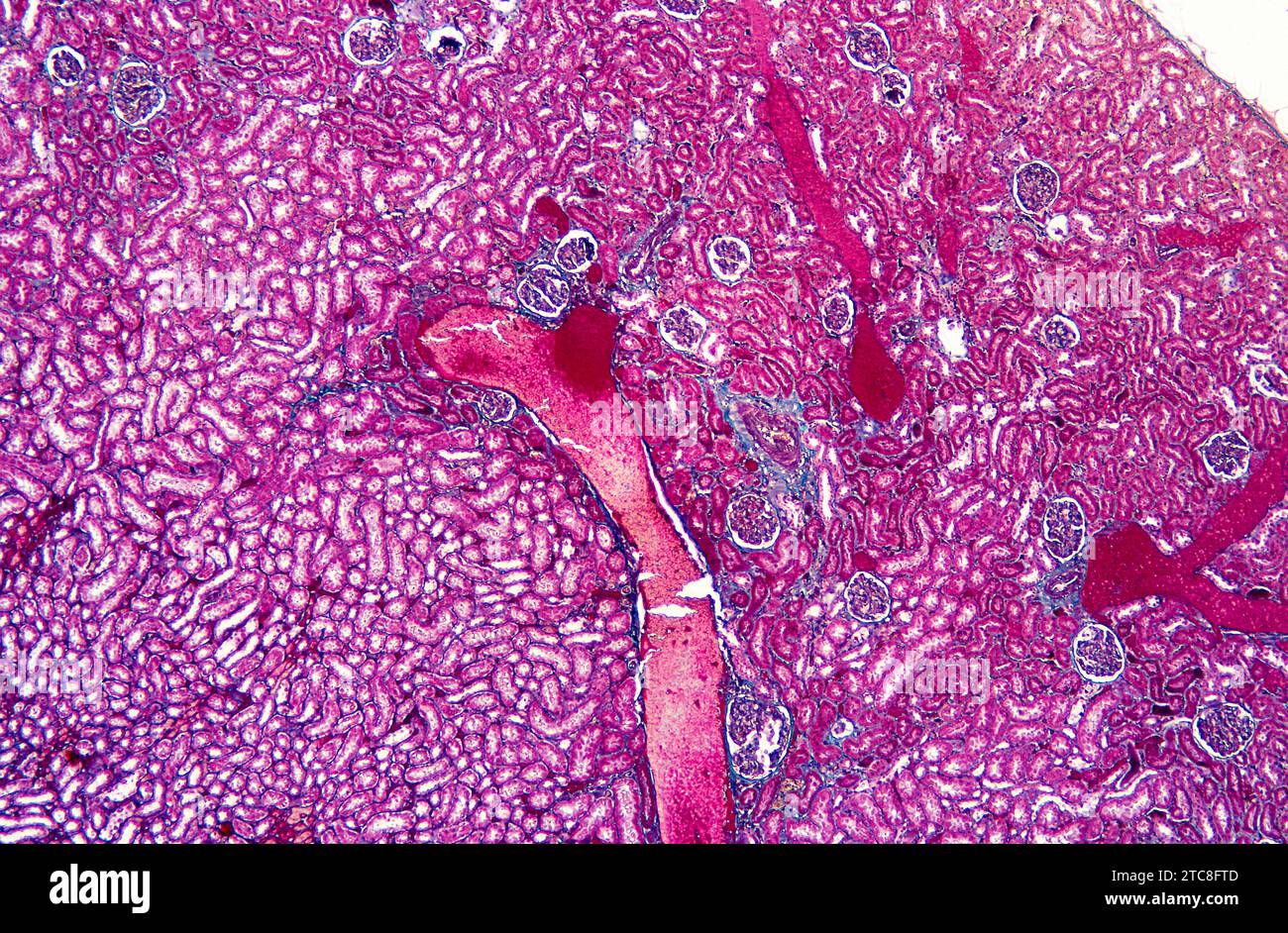 Renal capsule hi-res stock photography and images - Alamy