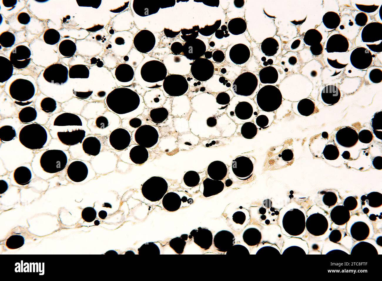 Adipose tissue with adipocites, stored lipids and nucleus. Optical ...