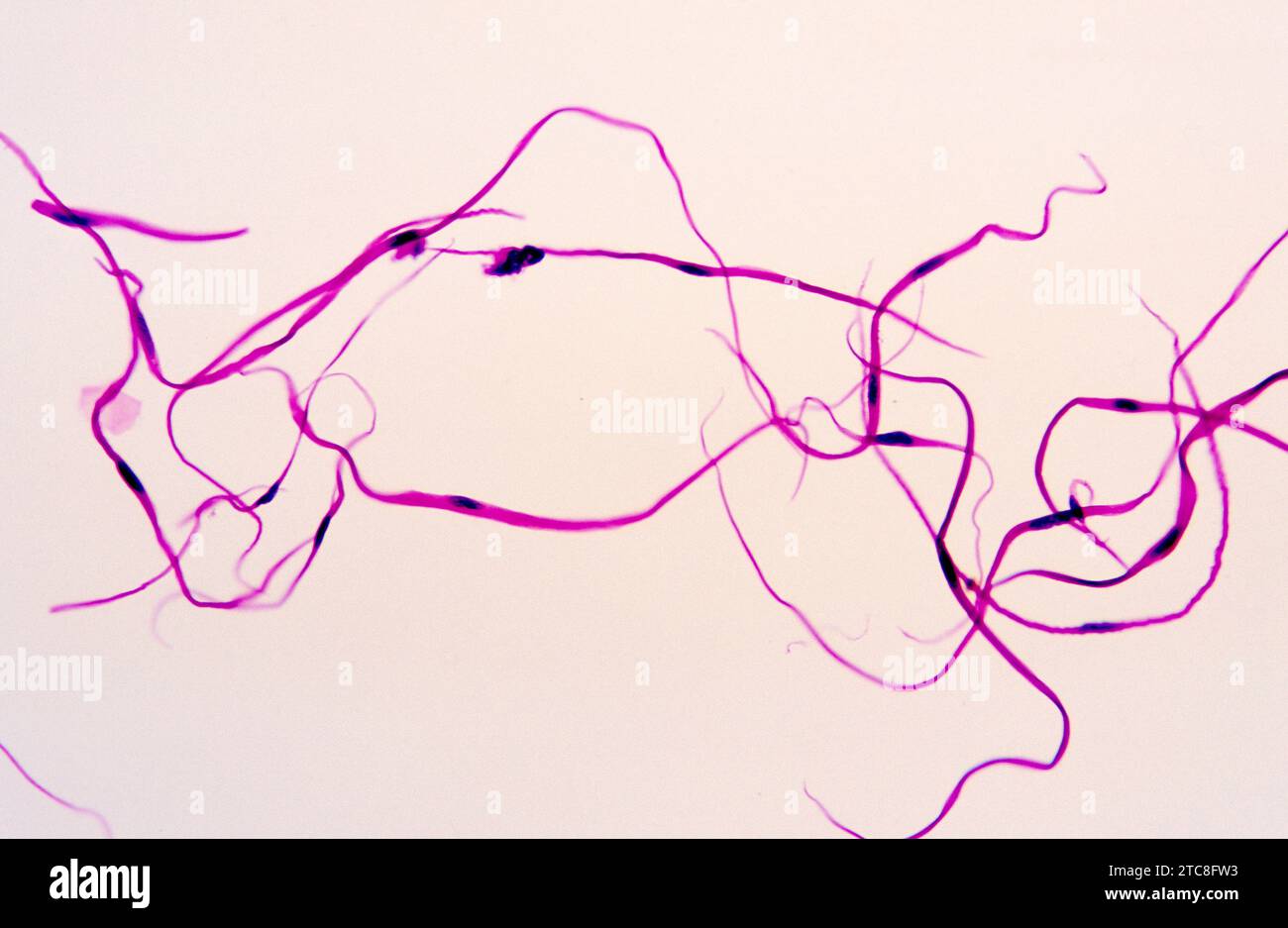 Smooth muscle tissue. Optical microscope, magnification X200 Stock ...