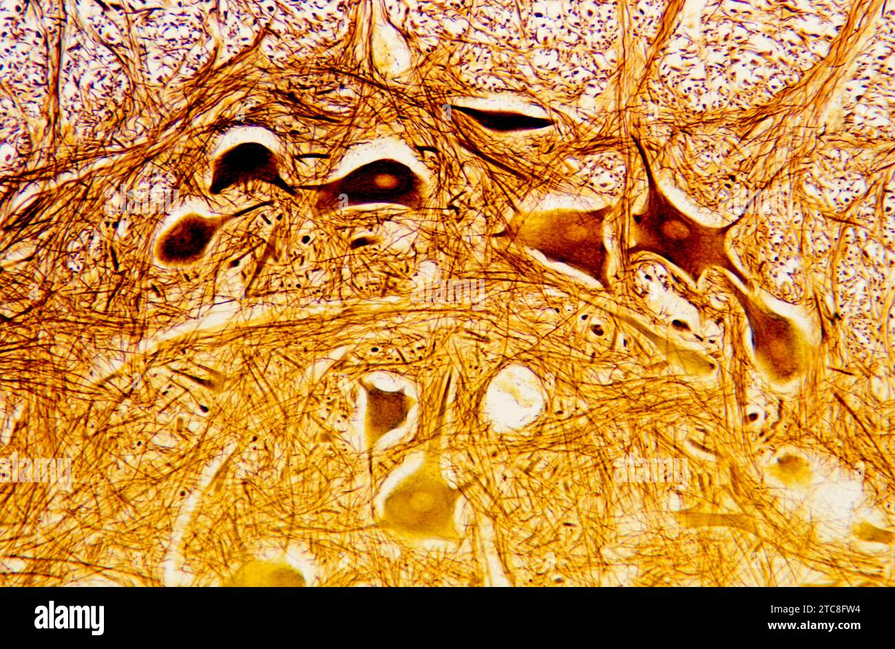 Neuron microscope hi-res stock photography and images - Alamy