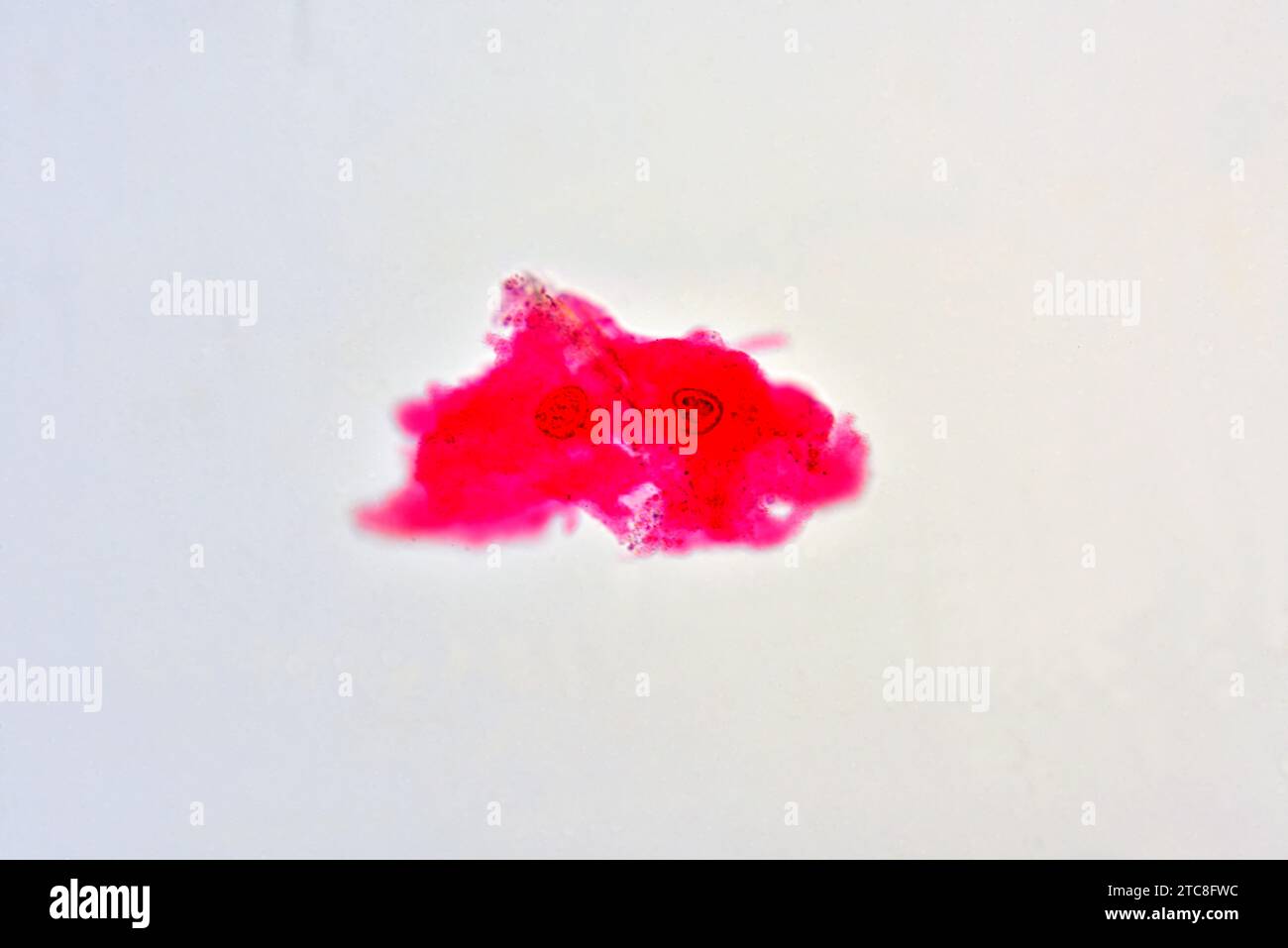 Amoeba proteus is a protozoan that uses his pseudopodia to phagocytize ...