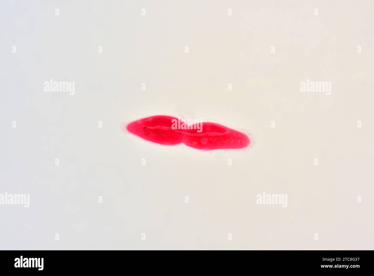 Paramecium or Paramoecium in binary fission. Optical microscope X200 ...