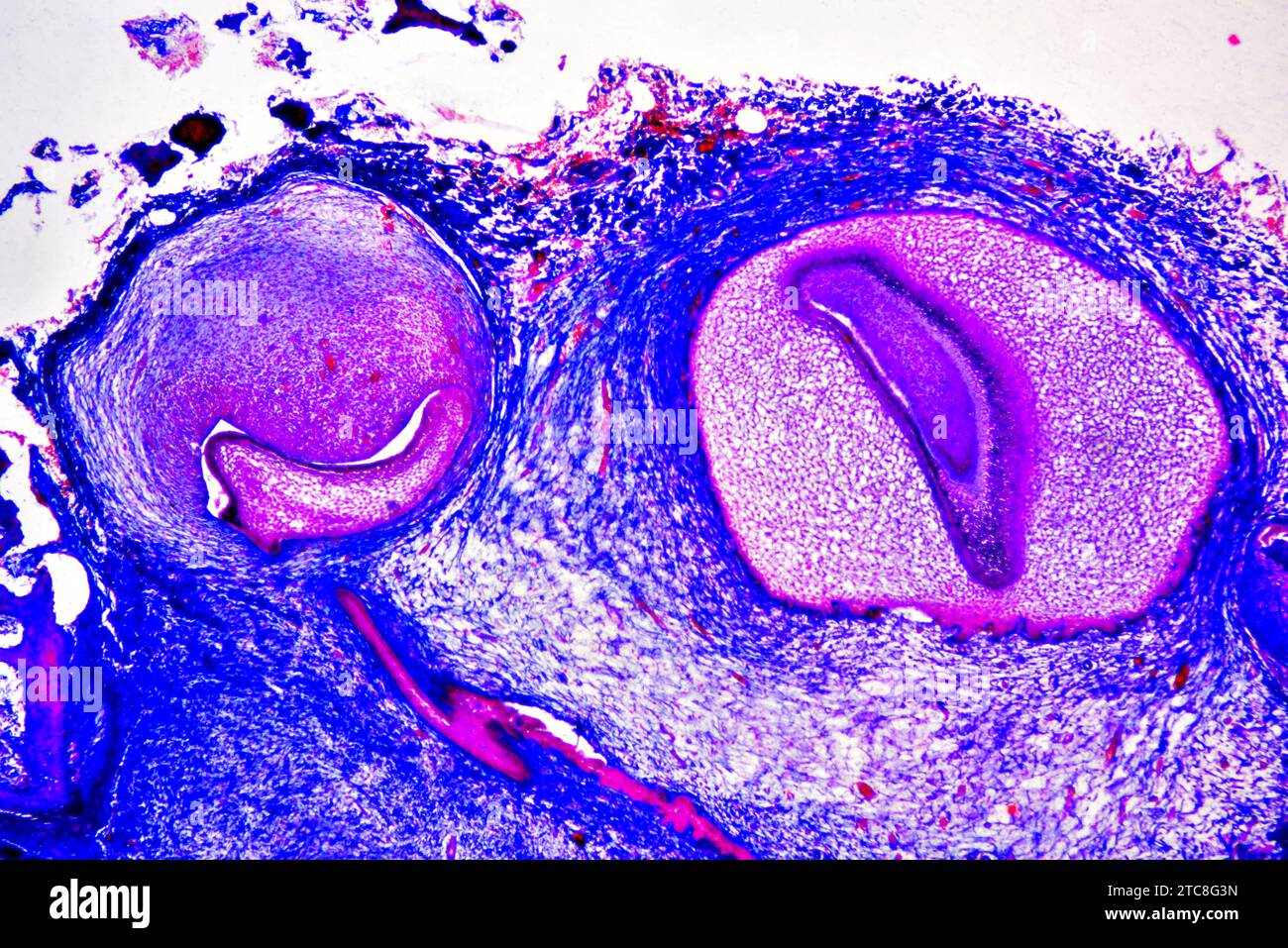 Connective tissue in a tooth in formation. Light microscope X40 at 10 ...