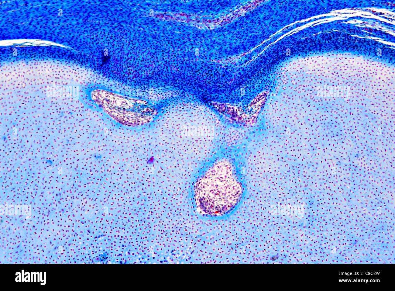 Connective tissue, transition of cartilage to bone in human fetus ...