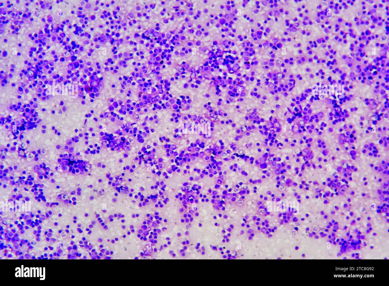 Lymphocytes and macrophages. Light microscope X300 at 10 cm wide Stock ...