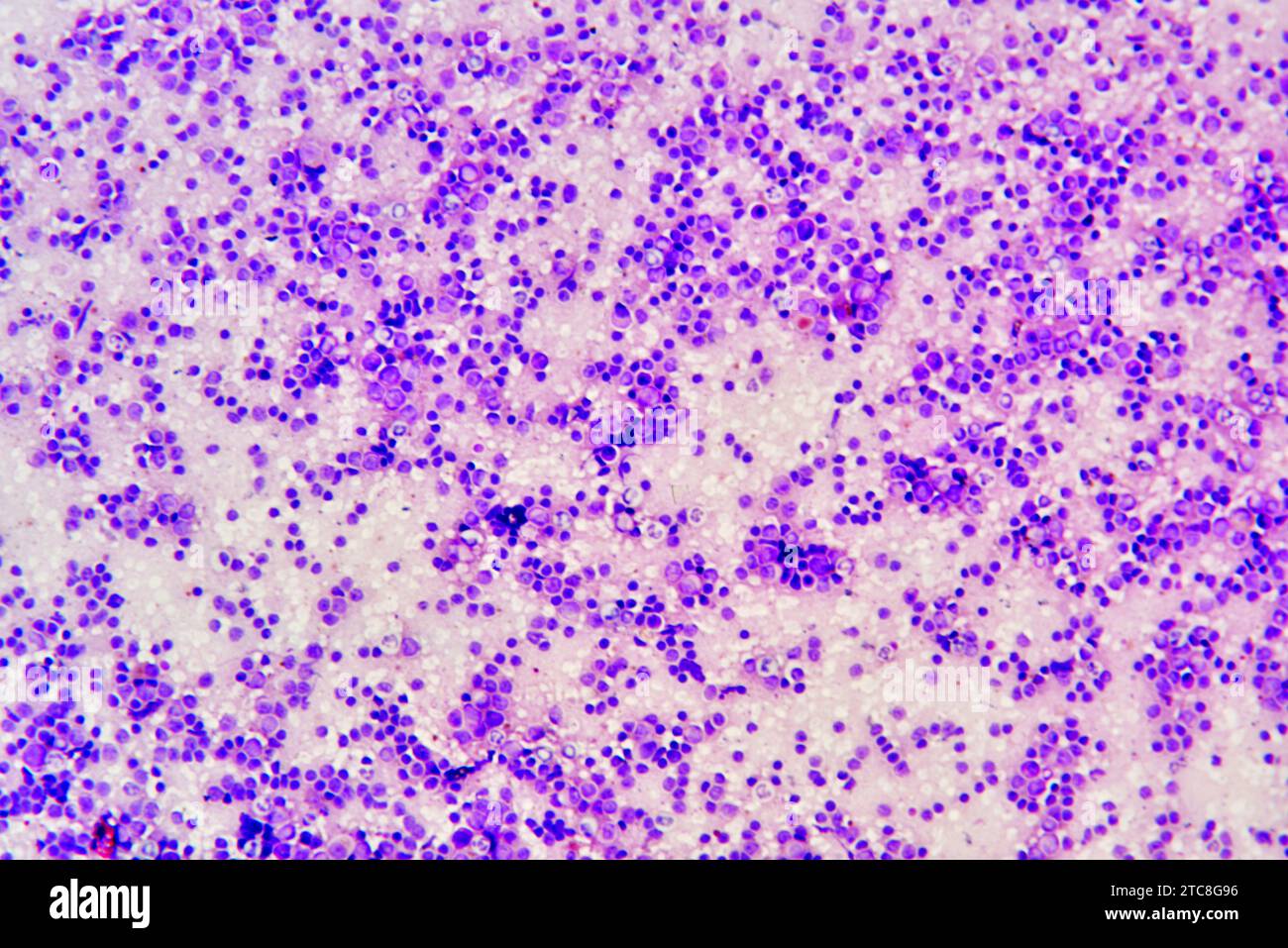 Lymphocytes and macrophages (immunity system). Light microscope X300 at ...