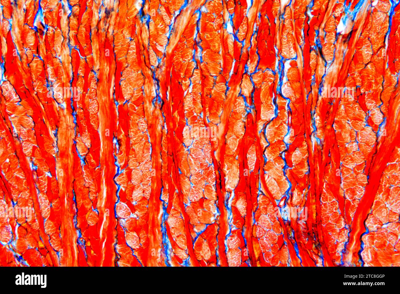 Skeletal muscle in cross and longitudinal section of tongue. Light ...