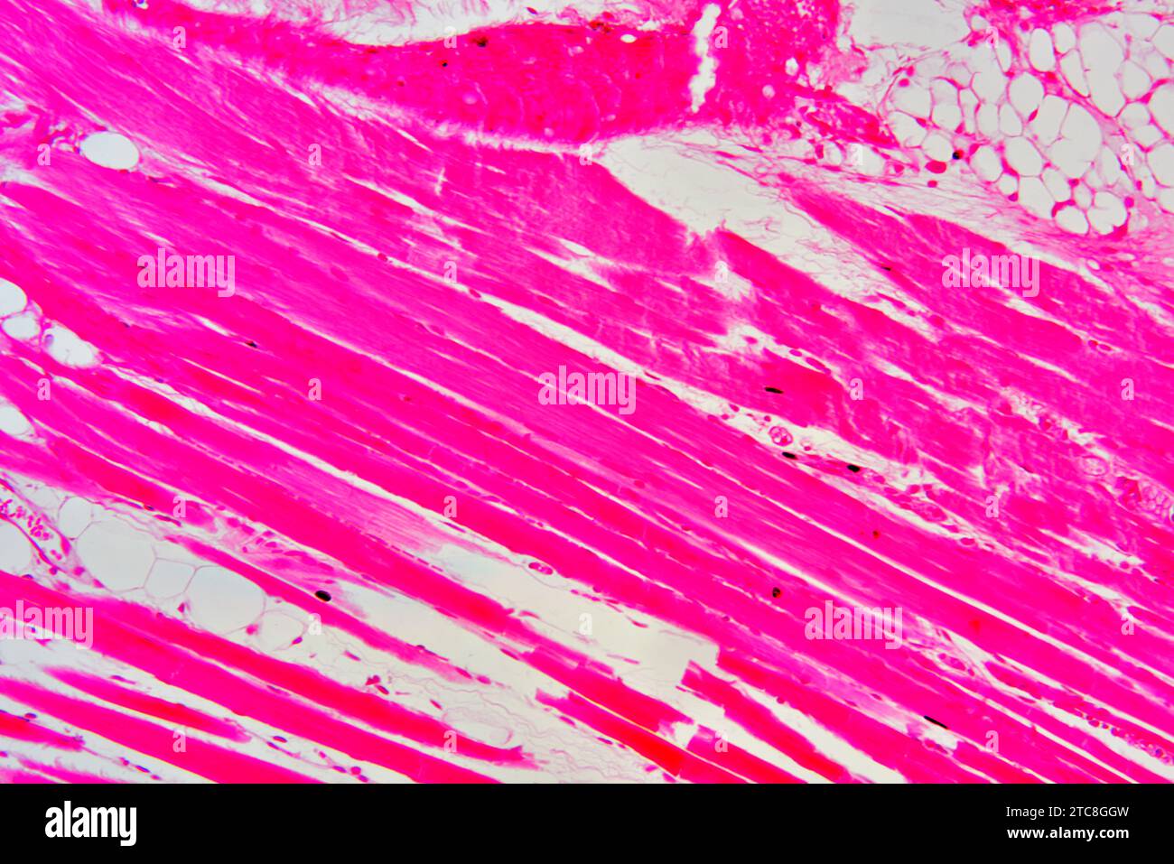 Skeletal trachea muscle in longitudinal section. Optical microscope ...