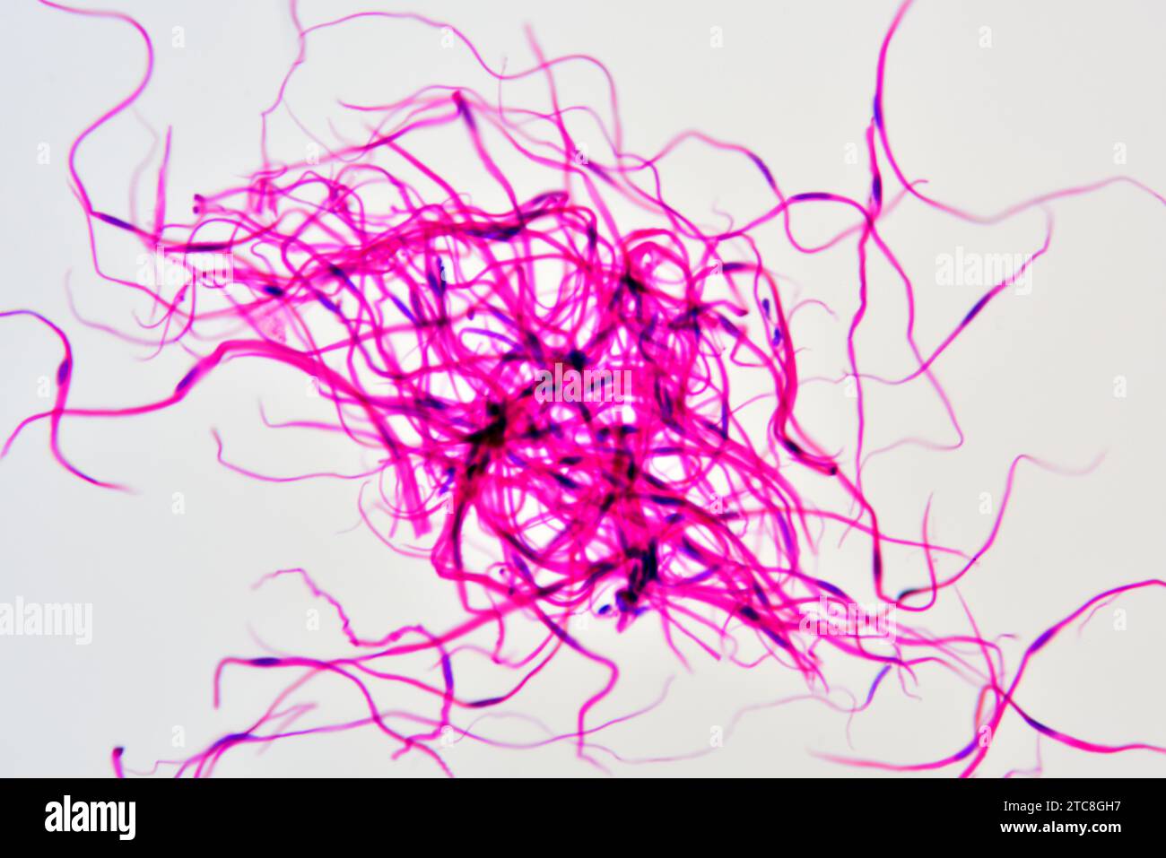 Smooth muscle (myocytes). Light microscope X300 at 10 cm wide Stock ...
